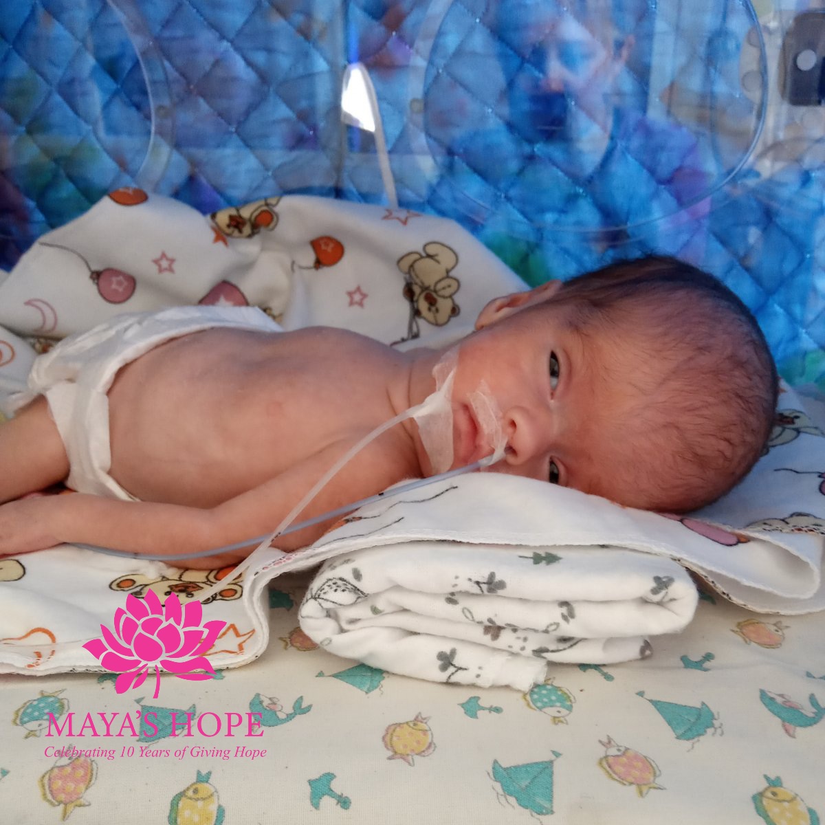 Maya's Hope: Shunt Surgery for a Baby Girl Born Prematurely | Maya's ...