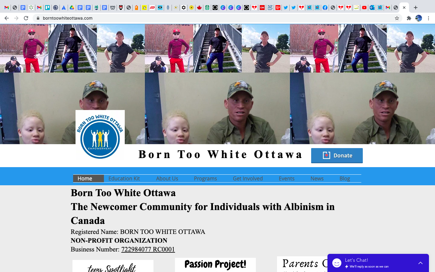 Donate to Support Newcomer Individuals with Albinism in Canada | Born ...